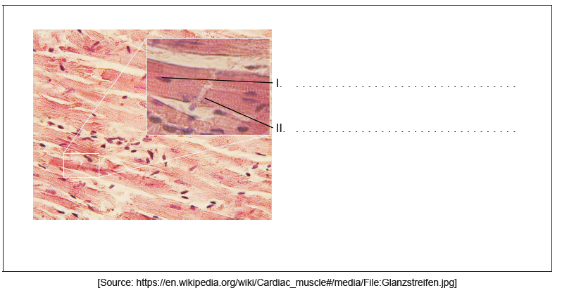 IB DP Physics Option D: Human physiology (Core topics) :D.4 The heart ...