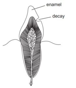 iGCSE Biology (0610)-7.3 Physical digestion - iGCSE Style Questions Paper 1