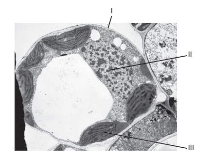 2018 May Biology paper 2 TZ2 SL