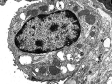 IB DP Biology Topic 1: Cell biology 1.2 Ultrastructure of cells Study Notes