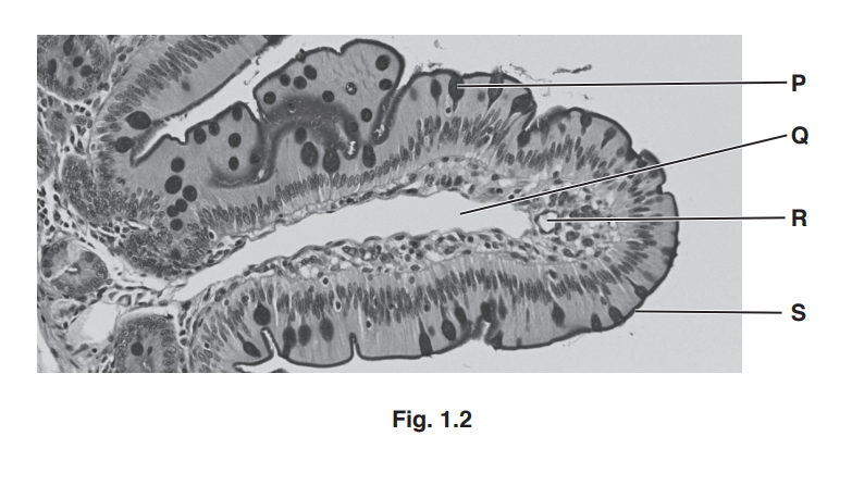 iGCSE Biology (0610)-7.2 Digestive system - iGCSE Style Questions Paper 4