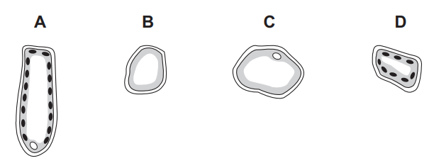 Igcse Biology 0610 6 2 Leaf Structure Igcse Style Questions Paper 2