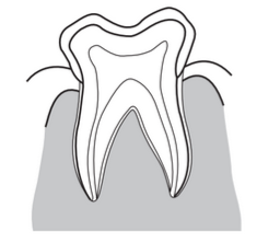 iGCSE Biology (0610)-7.3 Physical digestion - iGCSE Style Questions Paper 1