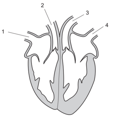 iGCSE Biology (0610)-9.2 Heart - iGCSE Style Questions Paper 1