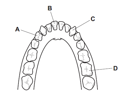 iGCSE Biology (0610)-7.3 Physical digestion - iGCSE Style Questions Paper 1
