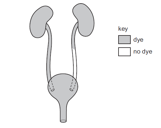 iGCSE Biology (0610)-13.1 Excretion in humans - iGCSE Style Questions ...