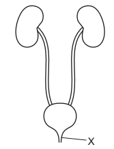 iGCSE Biology (0610)-13.1 Excretion in humans - iGCSE Style Questions ...