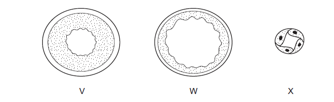 iGCSE Biology (0610)-9.3 Blood vessels - iGCSE Style Questions Paper 2