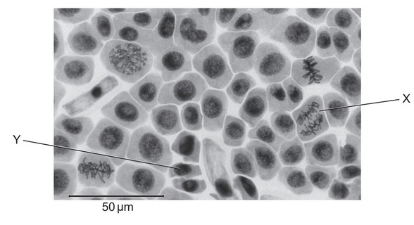 IB DP Biology- D2.1 Cell and nuclear division -FA 2025- IB Style ...