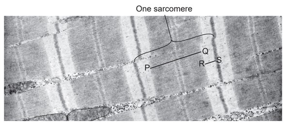 IB DP Biology-B3.3 Muscle and motility -FA 2025- IB Style Questions For ...