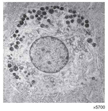 A level Biology 1.1 The microscope in cells study - Exam style question ...