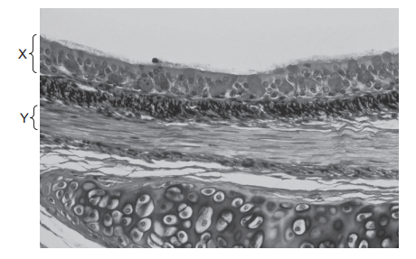 A level Biology 9.1 The gas exchange system - Exam style question - Paper 1