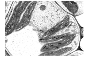 A level Biology 1.1 The microscope in cells study - Exam style question ...