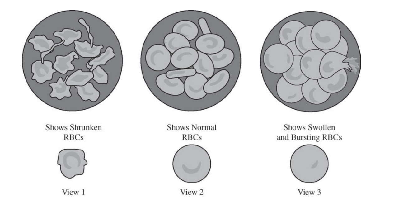 AP Biology : 2.8 Tonicity and Osmoregulation - Exam Style questions ...