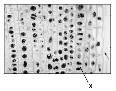 IB DP Biology- D2.2 Gene expression -FA 2025- IB Style Questions For HL ...