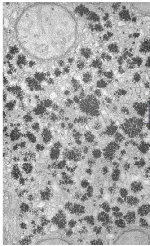 IBDP Biology 2025 SL&HL: B1.1 Carbohydrate and Lipid Study Notes