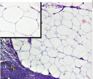 IBDP Biology 2025 SL&HL: B1.1 Carbohydrate and Lipid Study Notes