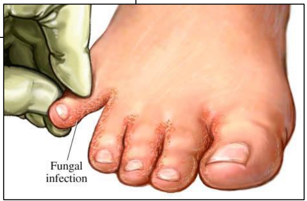 IBDP Biology 2025 SL&HL: C3.2 Defence against disease Study Notes