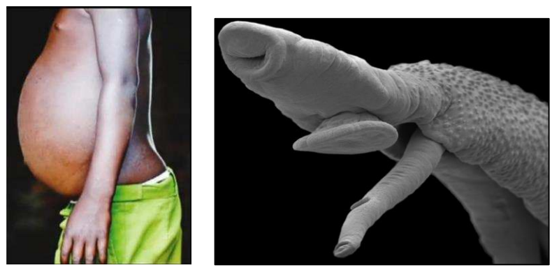 IBDP Biology 2025 SL&HL: C3.2 Defence against disease Study Notes