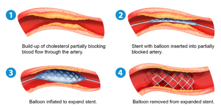 IB MYP Biology Circulation, transpiration and translocation Practice ...