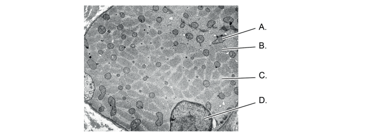 IB DP Biology-B3.3 Muscle and motility -FA 2025- IB Style Questions For ...