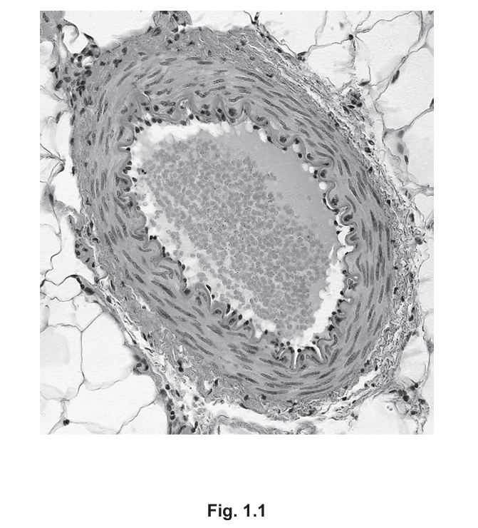 iGCSE Biology (0610)-9.3 Blood vessels - iGCSE Style Questions Paper 3