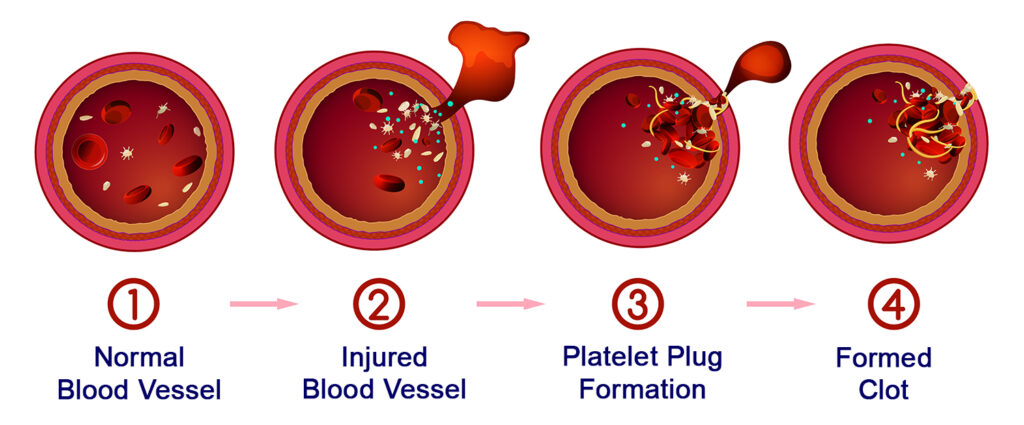 Edexcel iGCSE Biology-3.14 B Platelets & Blood Clotting- Study Notes